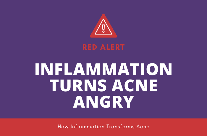 When Acne Turns Angry: The Inflammatory Side of Breakouts