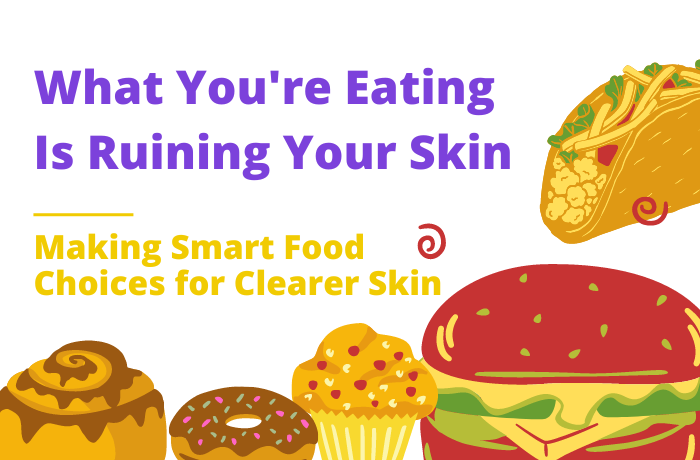 Blame Your Burger: How Your Diet Contributes to Acne